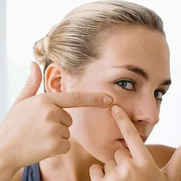 Beauty special: Here are 5 skin habits that cause acne and pimples