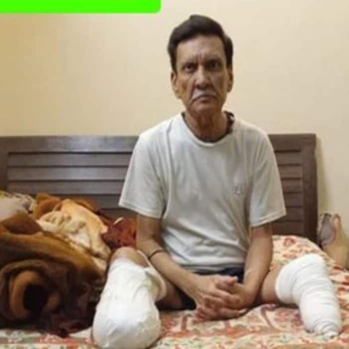 Both legs of Hindu cricketer in Pakistan cut due to...