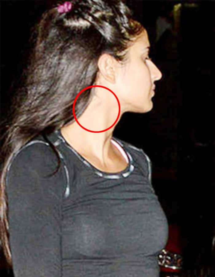 10 Bollywood Celebrities Who Were Snapped With Hickeys & Love Bites