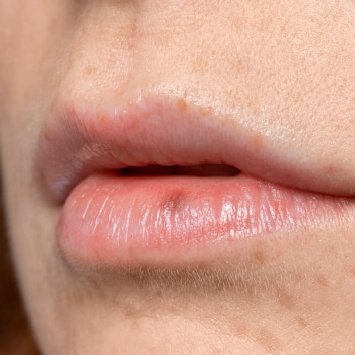 7 early signs of vitamin B deficiency you cannot ignore