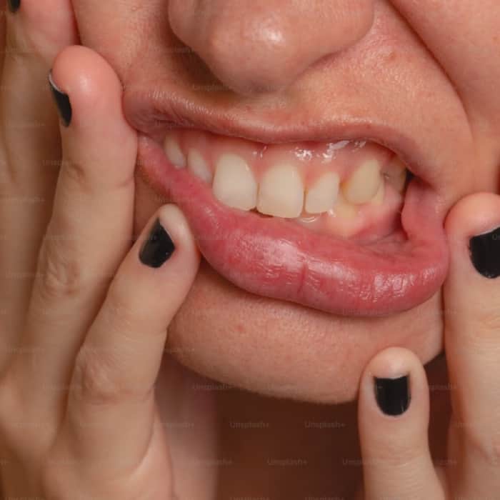 Vitamin B12 Deficiency: 7 warning signs and symptoms you shouldn't ignore