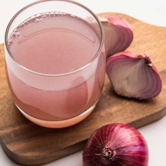 7 Effective Uses of Onion Juice to Combat Excessive Hair Loss