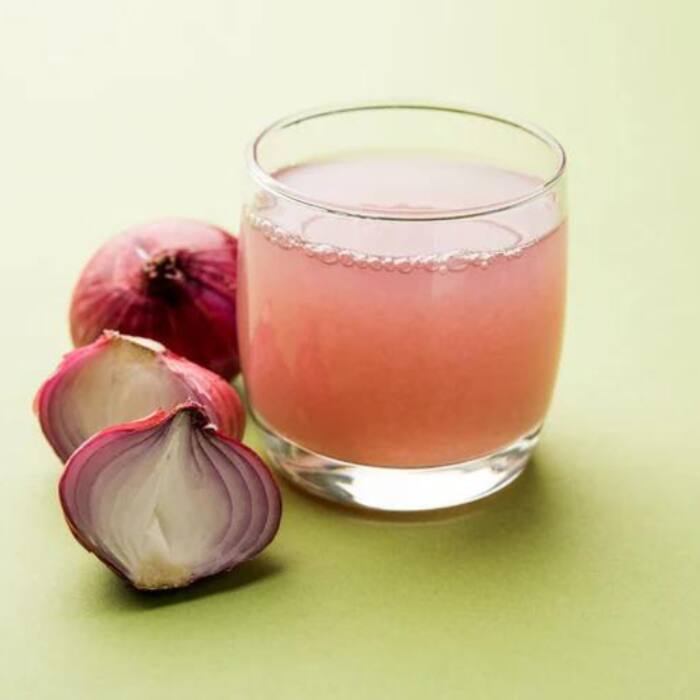 7 Effective Uses of Onion Juice to Combat Excessive Hair Loss