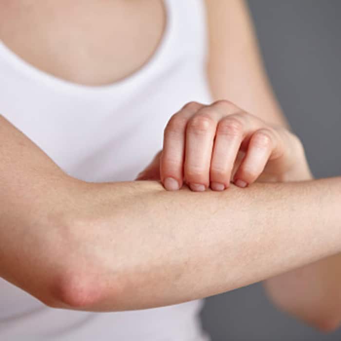 Check out symptoms of Chikungunya