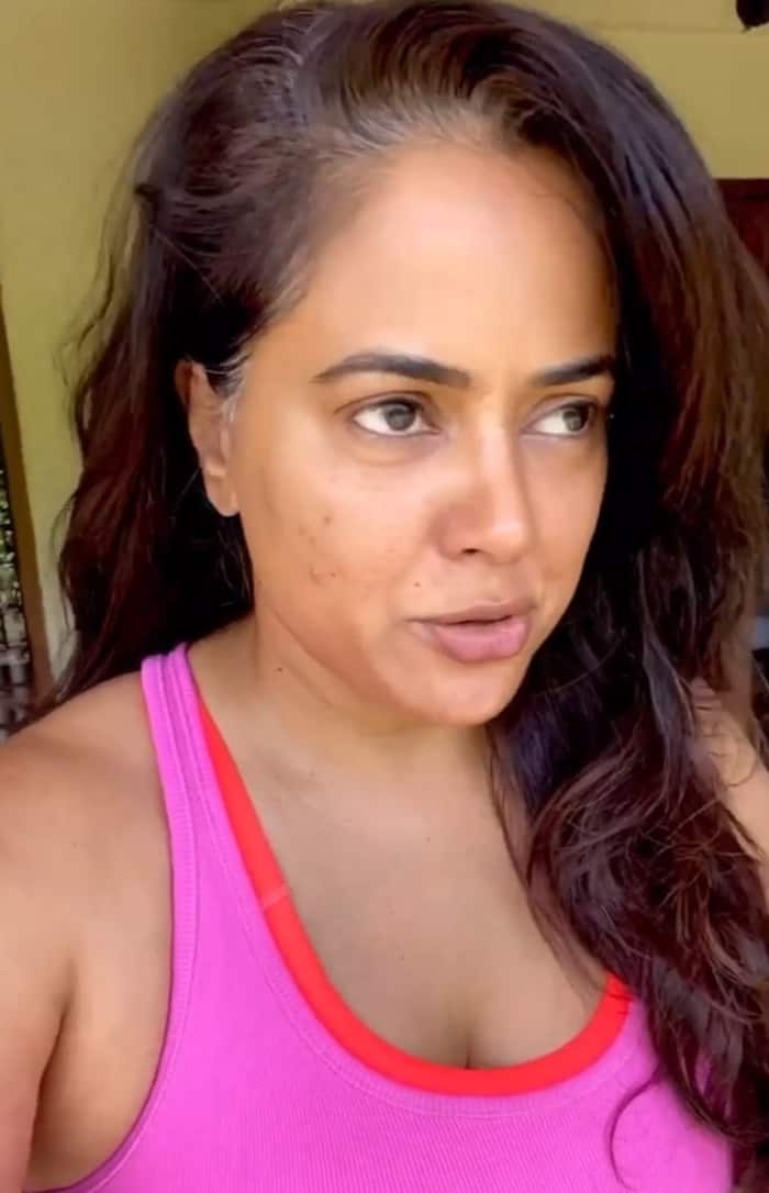 From Mindy Kaling to Yami Gautam, 5 Celebrities Who Are Vocal About Their Skin Issues