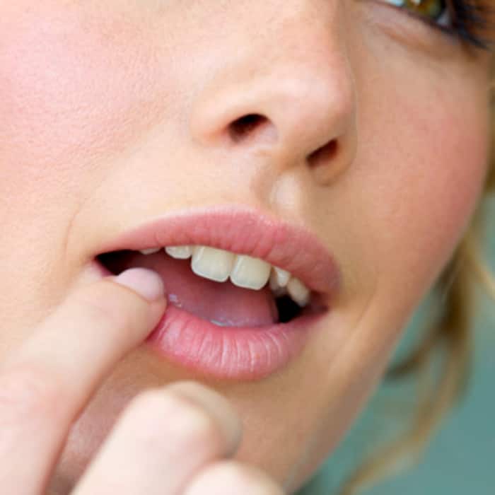 Scrub your lips to remove sun tan