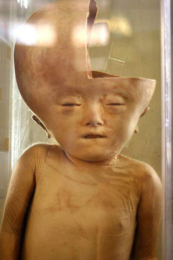 Specimen of human face at Museum of Death in Bangkok