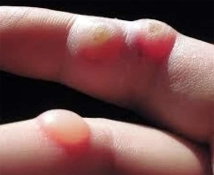 Lesser-Known Facts About Black Death, World's Biggest Catastrophe in ...