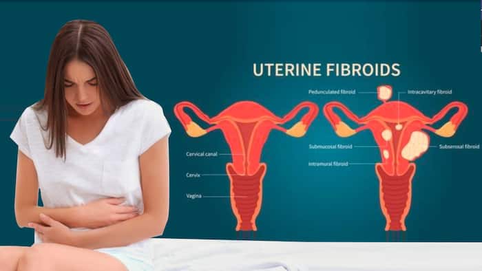 What is Uterine fibroids? When Should You See a Doctor? All You Need to ...