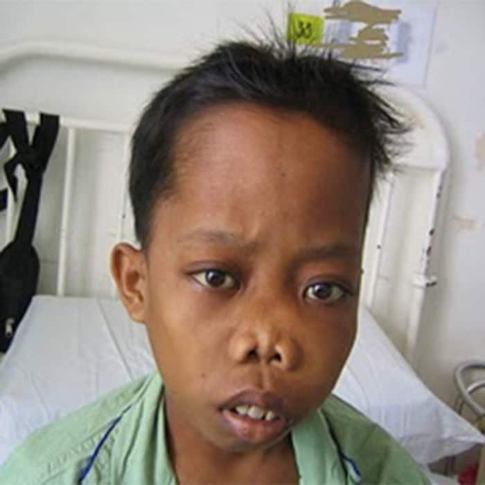 Types of Thalassemia