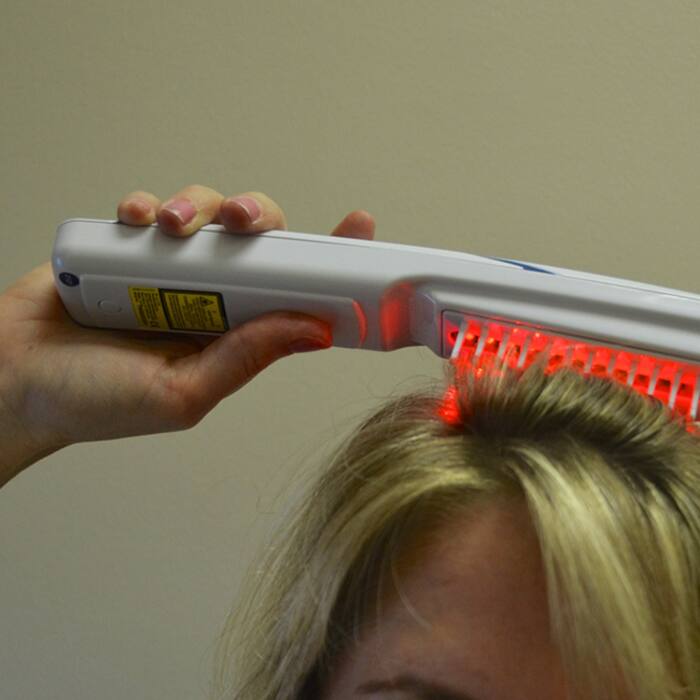 9 easy and feasible tricks you can avoid hair thinning with!